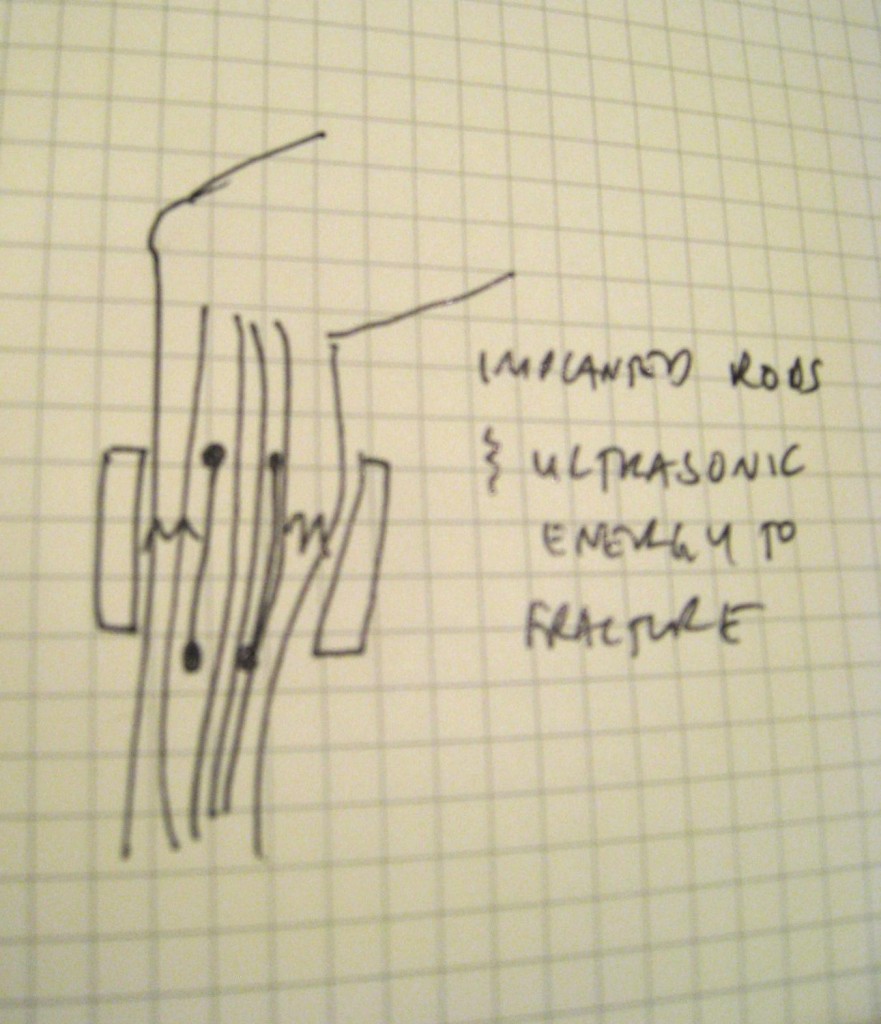Noninvasive Bone Distraction Using A Shape Memory Implant (Breakthrough ...