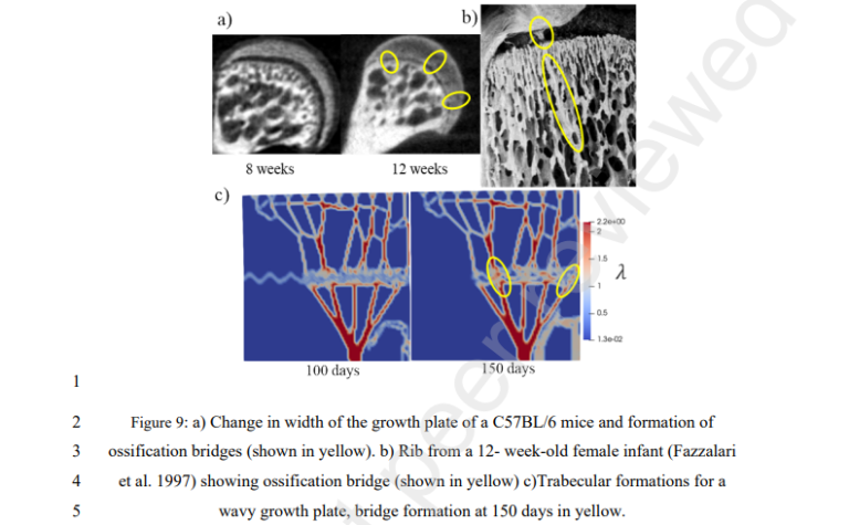Bone Development